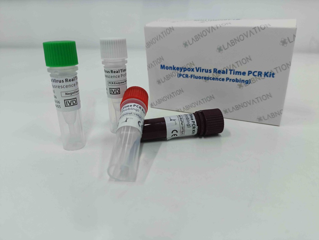 Monkeypox Virus PCR Rapid Test Kit Real Time For Human Serum Lesion ...